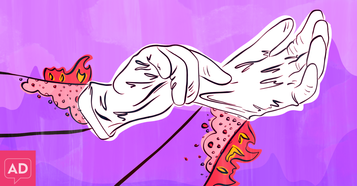 Latex Sensitivities and Eczema | AtopicDermatitis.net